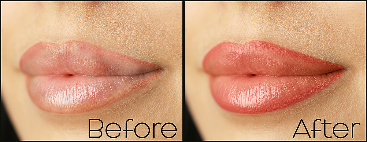 Usta: wypełnianie, powiększanie i makijaż permanentny AGNIESZKA RADZI ...